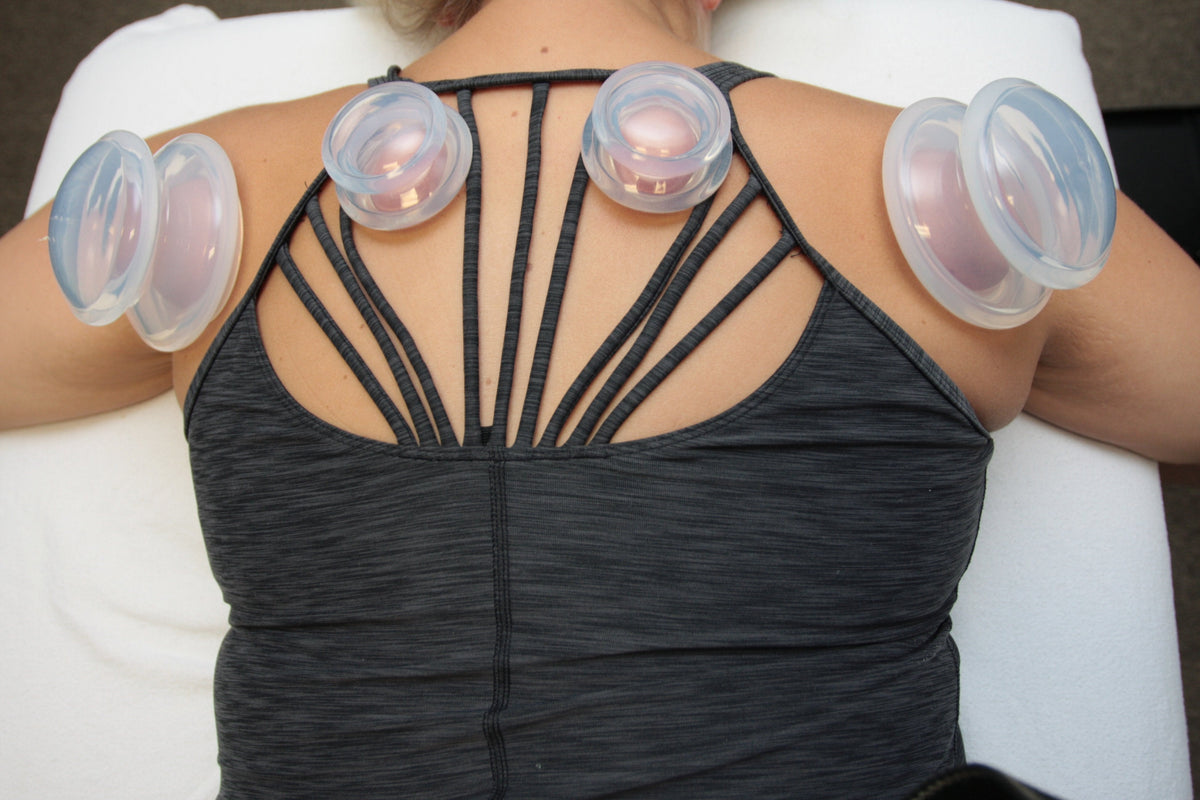 Live Online Evidence Informed Clinical Cupping - Levels 1-4 – Cupping USA